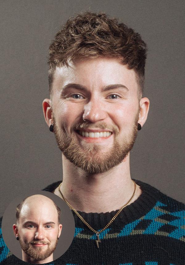 Lace & Skin Men’s Hair System with Upgraded Hair