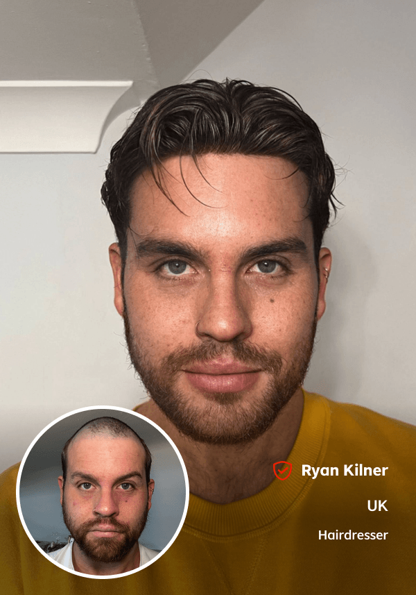 Frontal Hairpiece | Men's Oversized Frontal Hair System