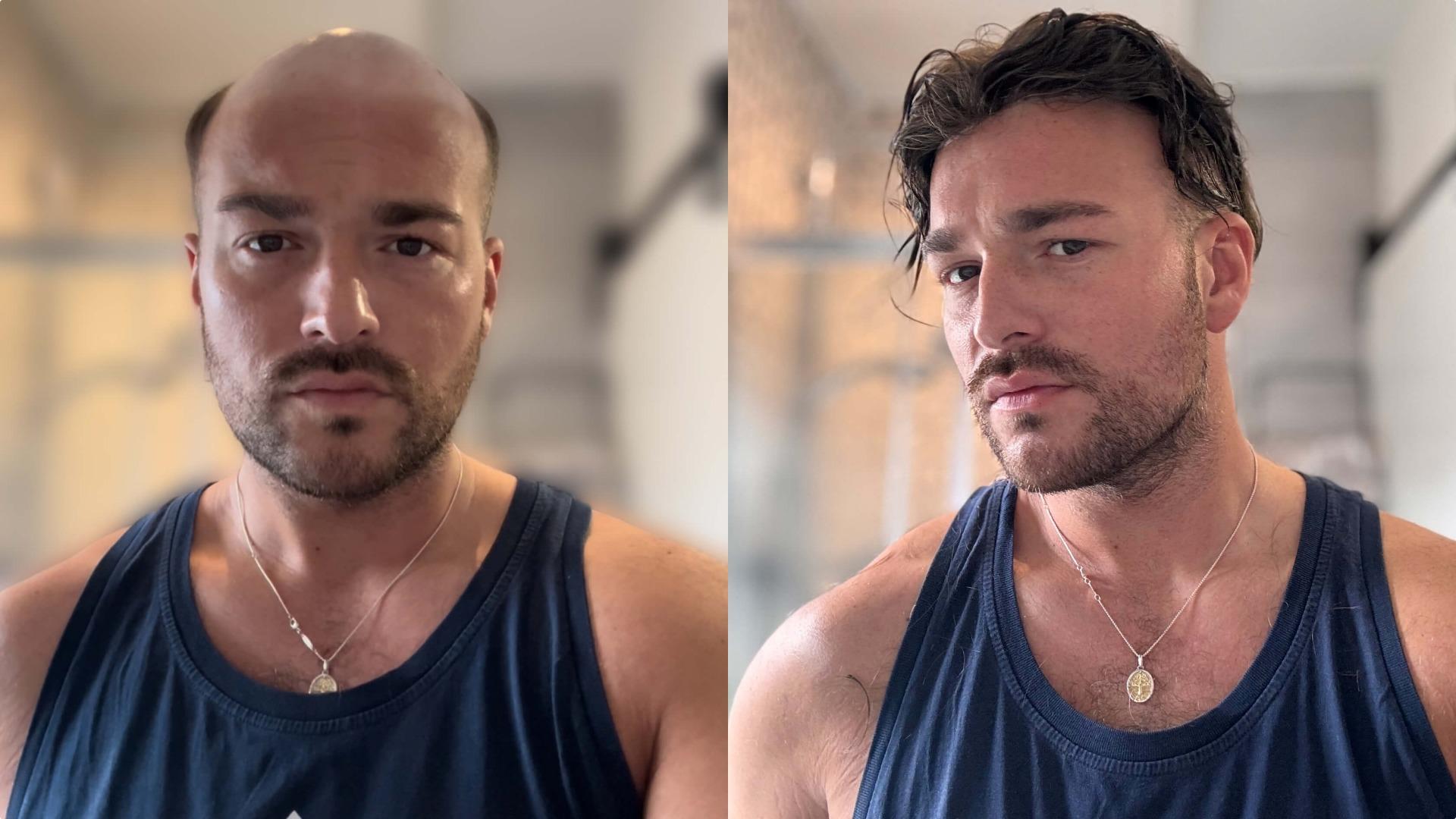 Men's Wigs | Human Hair Systems for Men - Lordhair