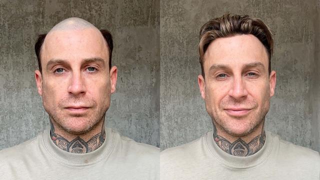 Premium Men's Wigs | Shop Human Hairpieces & Male Wigs