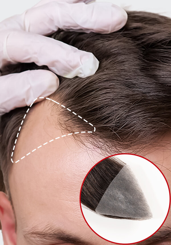 Temple Hair Patch for Men