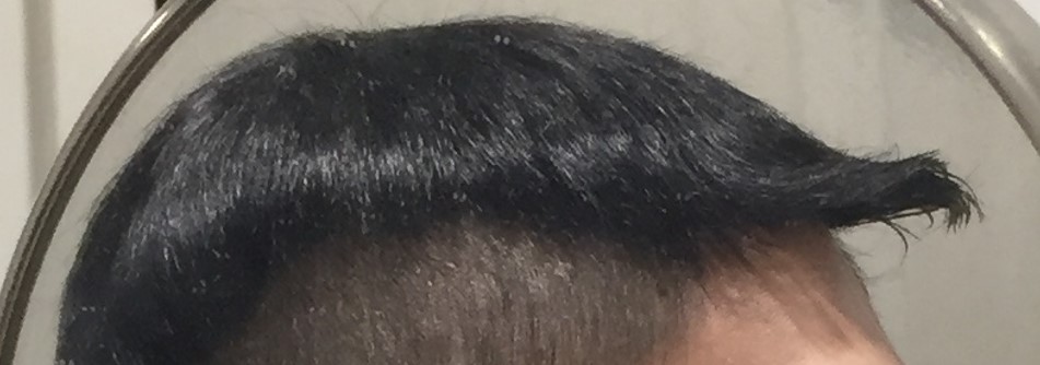 Invisible Thin Skin Hair System | Natural Front Hairline Mens Hairpieces