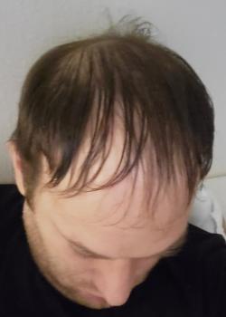 Hollywood lace: Men’s Clip Hair System with Lace Front