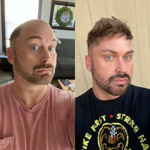 Full Cap Hair Systems for Men | Wigs for Bald Men | Lordhair